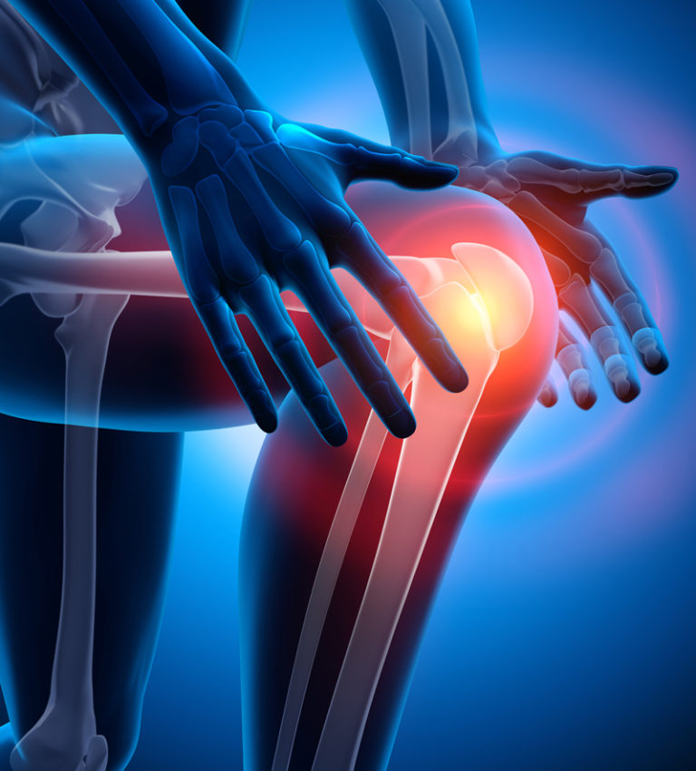 Knie-OP: Erkrankungen, Verfahren, Alltagstipps & Reha